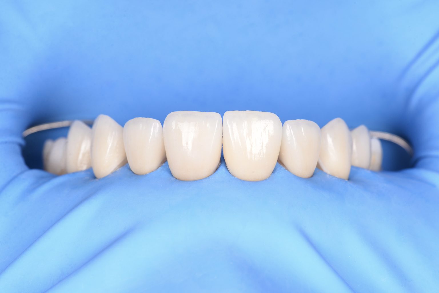 Clinica Doctor Ursu – Servicii Complete de Medicină Dentară